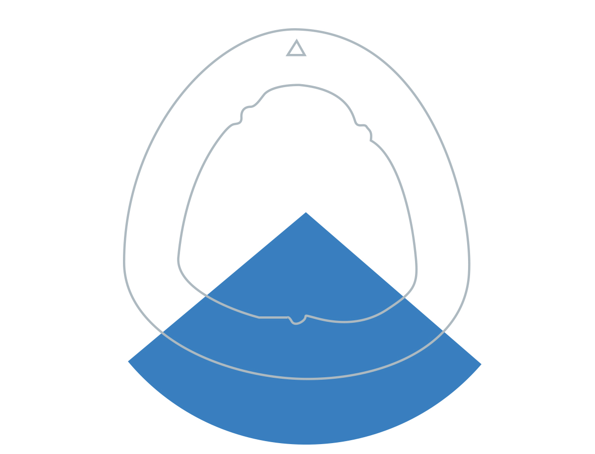 Downflo Evolution DFE Cartridge Dust Collector | Donaldson Industrial ...